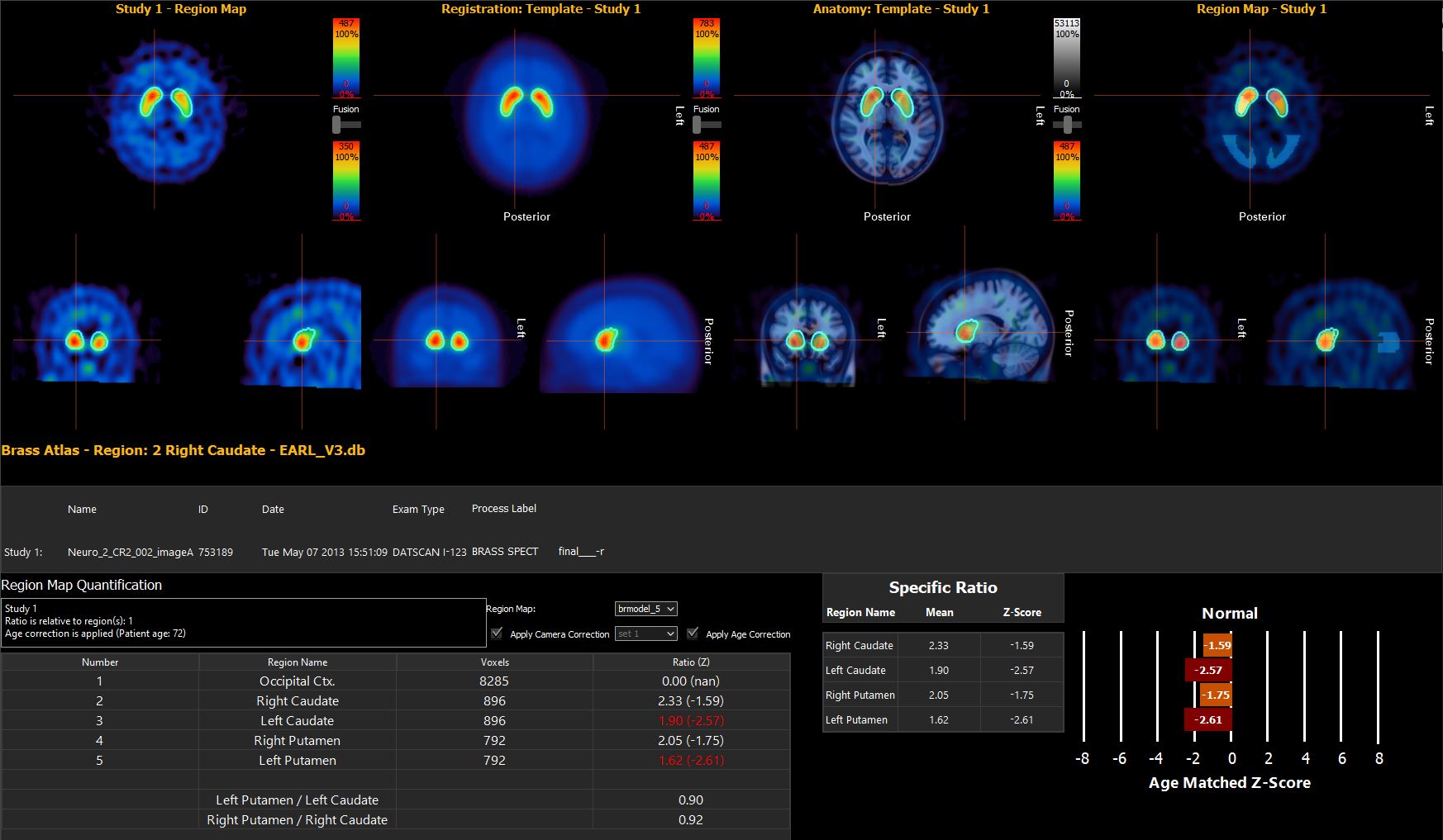 Neurology | Hermes Medical Solutions